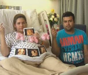 the conjoined triplets