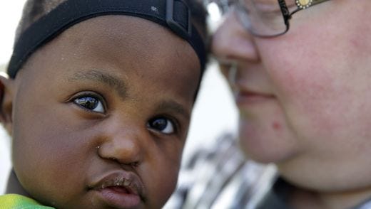 Baby who lived in a bubble thrives after rare transplant