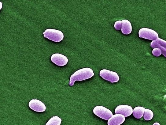 Pentagon: Poor testing led to Army shipping live anthrax