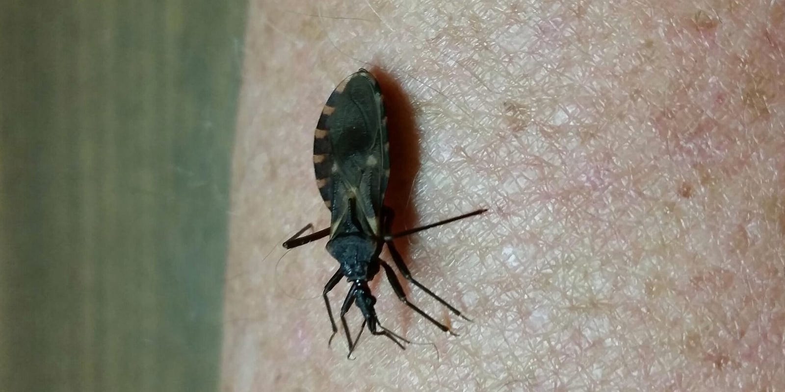 Texas bug transmits deadly disease after bite