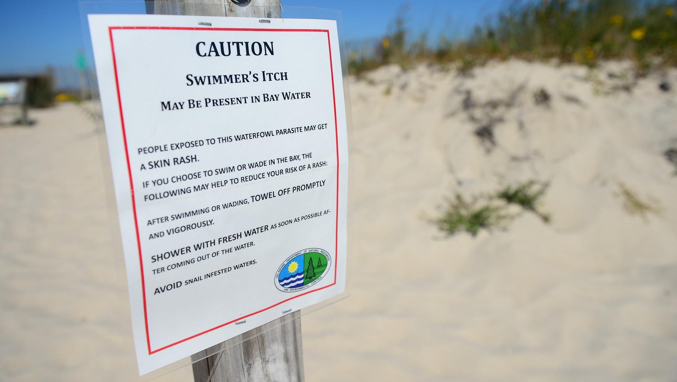 'Swimmer's itch' parasite in Delaware Bay burrows in skin, causes bumps