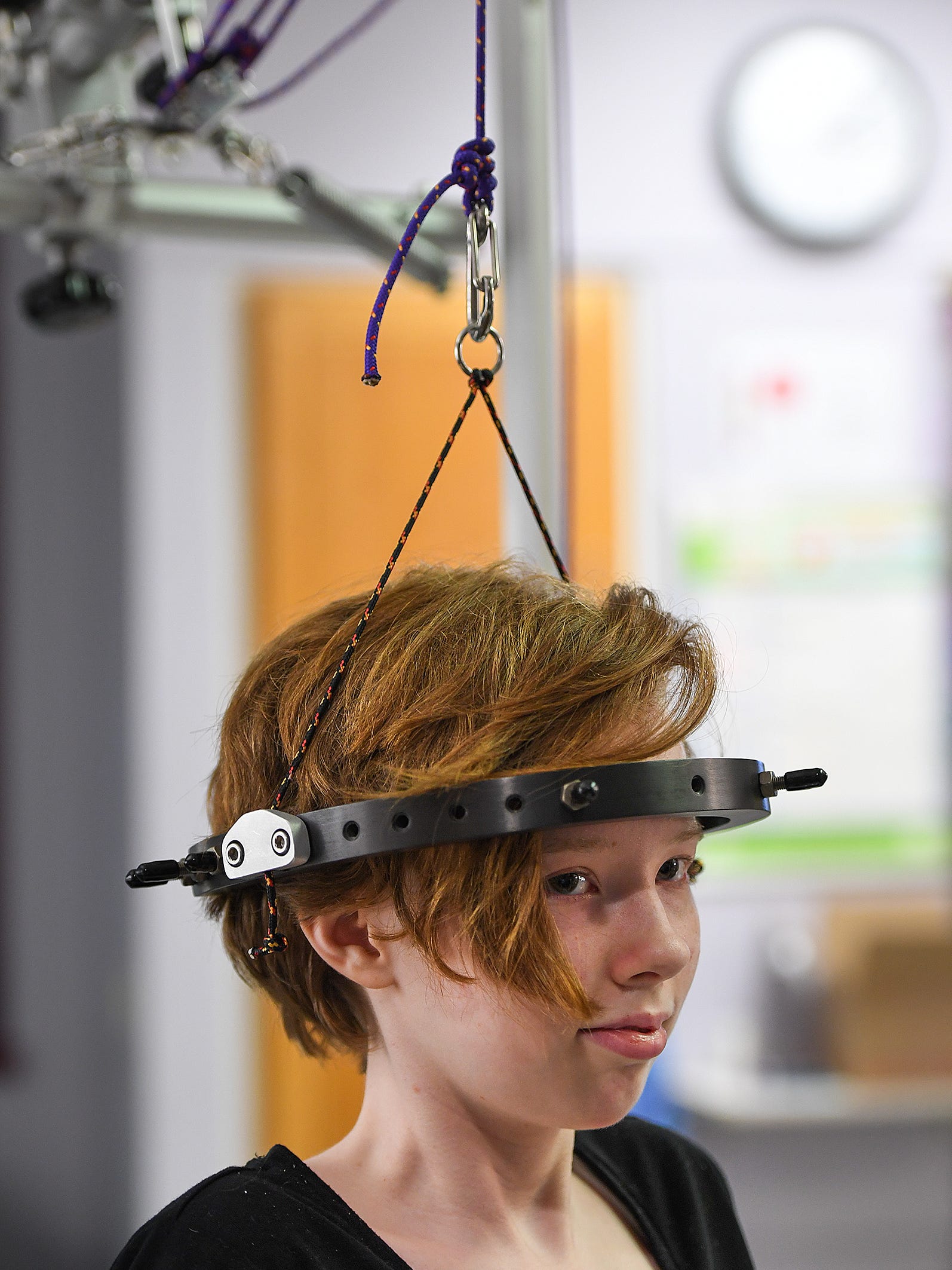 Scoliosis treatment at Greenville Shriners helps kids with severe form