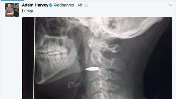 Australian journalist shot in the neck by stray bullet in Philippines