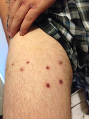 3 deputies placed on leave after lawsuit claims excessive force was ...