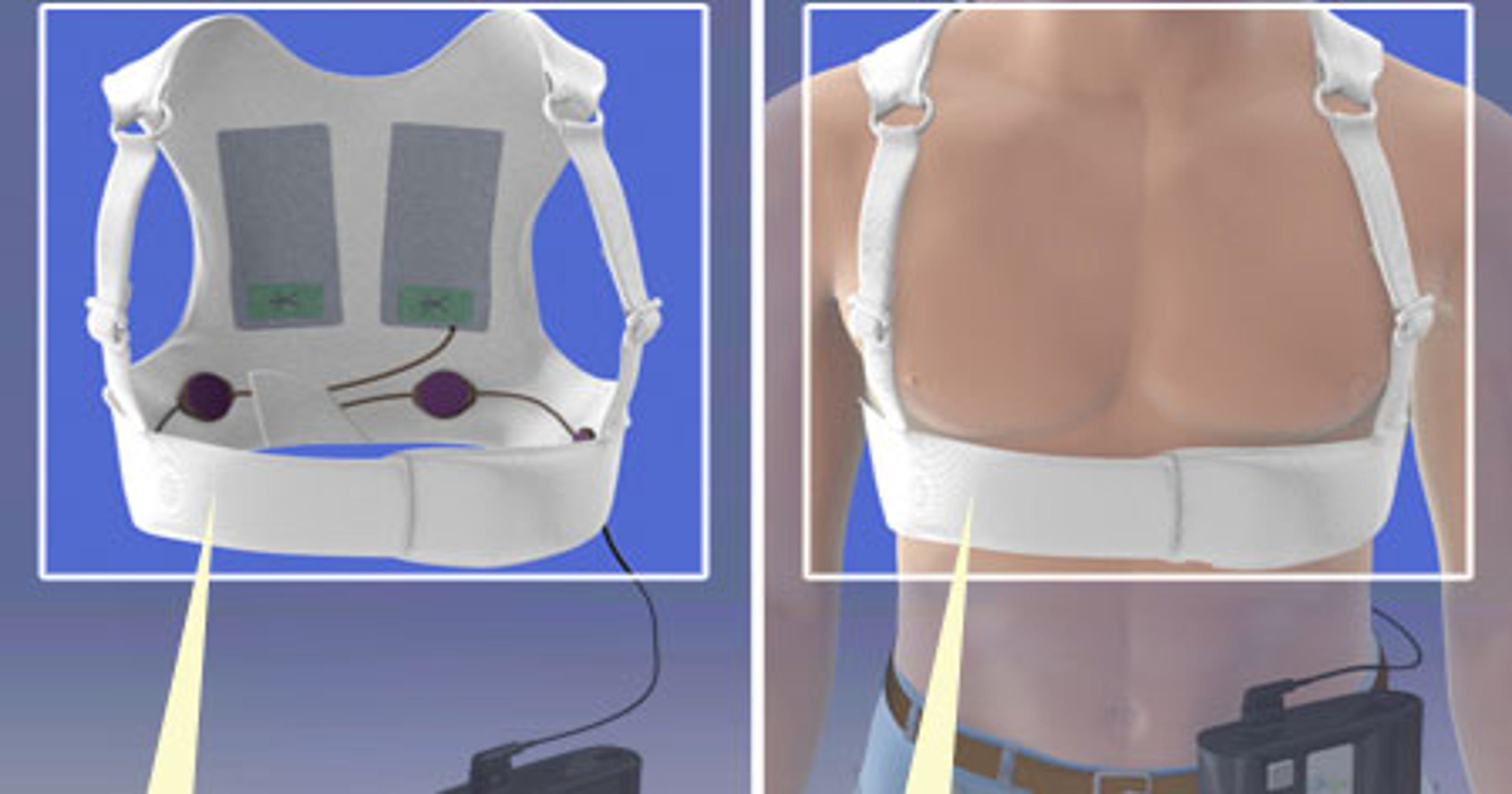 Defibrillator vest saves man from death 3 times
