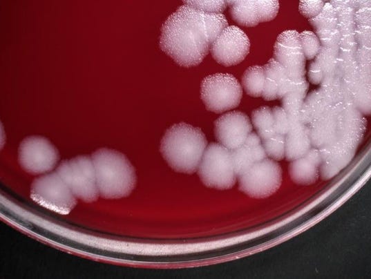 In key anthrax test, scientist just threw out test tube showing sample ...
