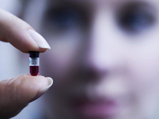 Theranos' finger-stick blood testing gets FDA approval