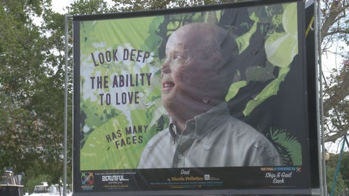 Outdoor art exhibit teaches Embracing our Differences | wtsp.com