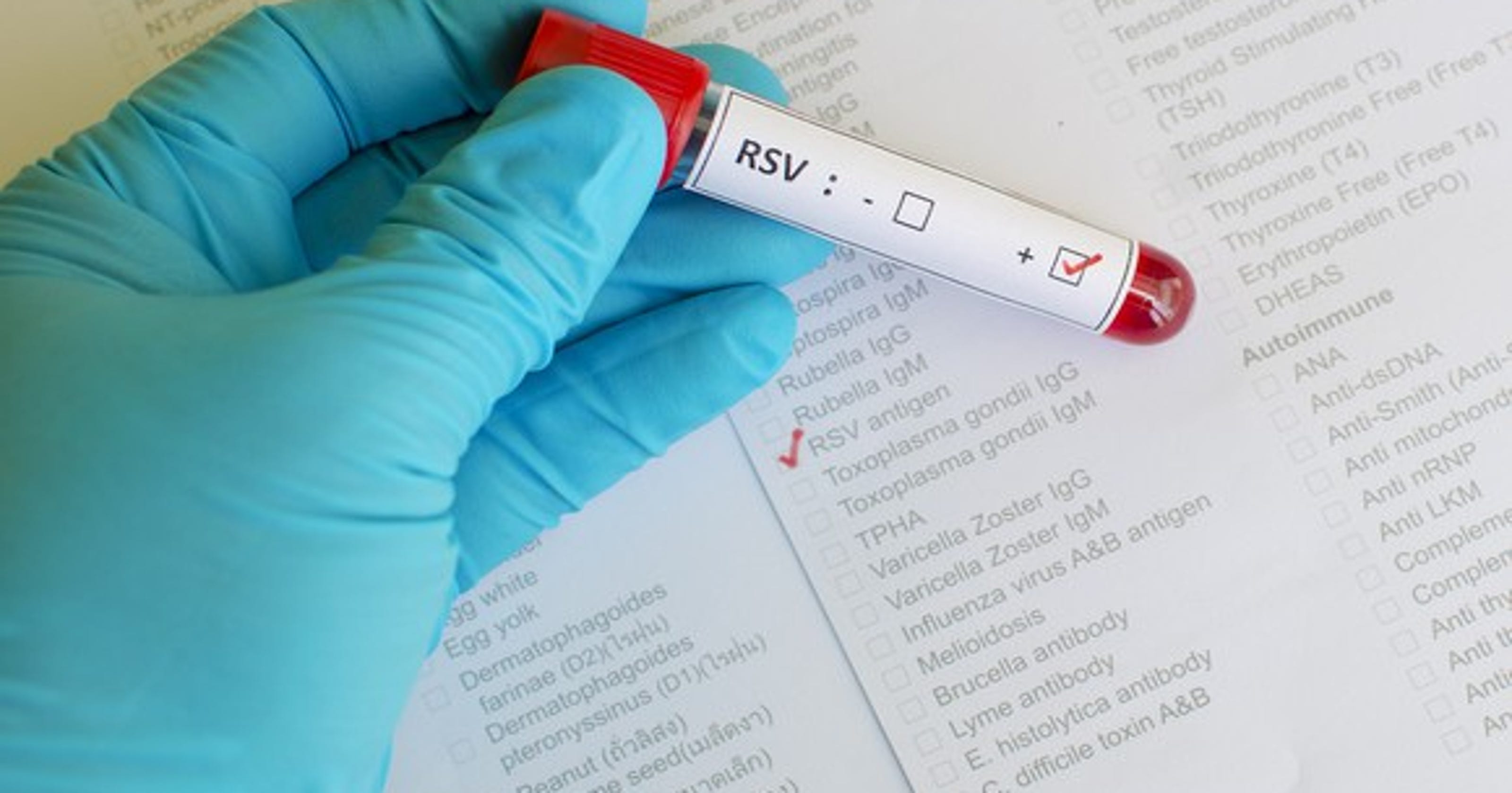 RSV rise in Louisville: How to prevent virus from spreading