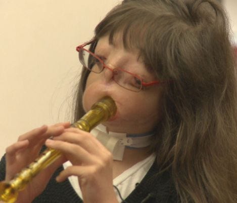 Girl born without a face has undergone 45 surgeries | 13newsnow.com