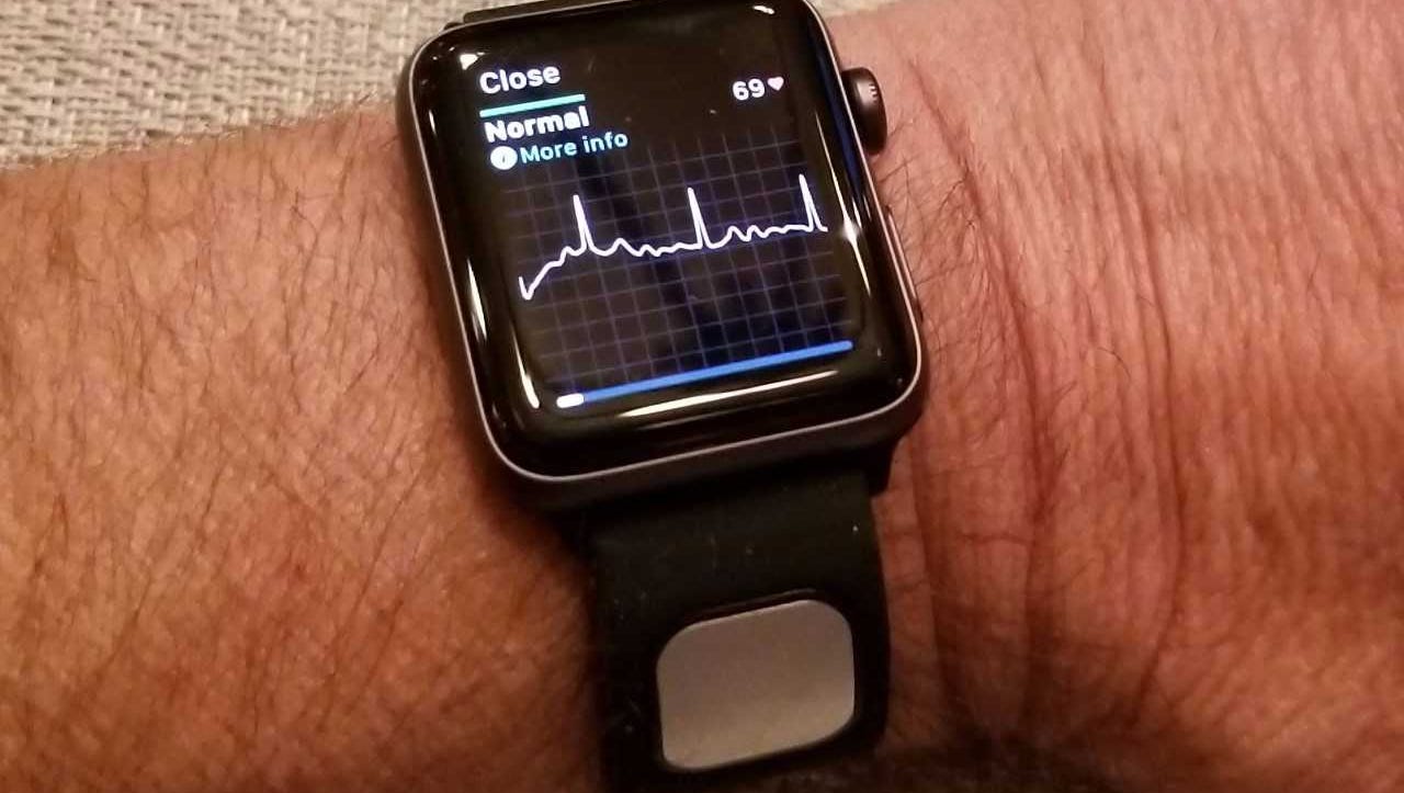 Heart attacks: These bands now offer medical grade alerts