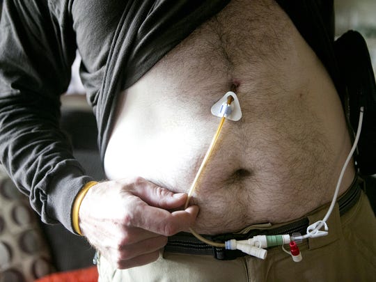 New pump helps man battle Parkinson's