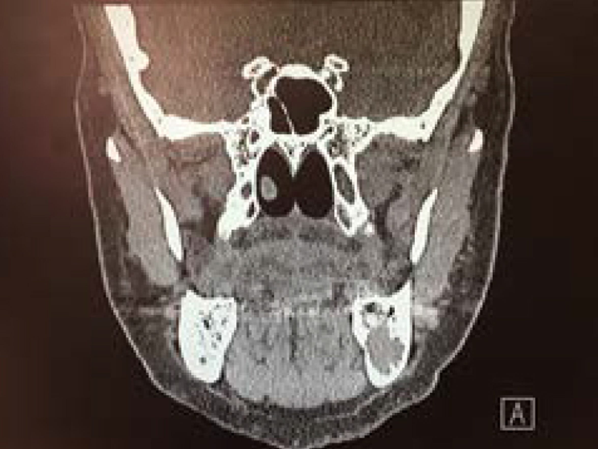 'I no longer trust them to fix me when I’m broken'