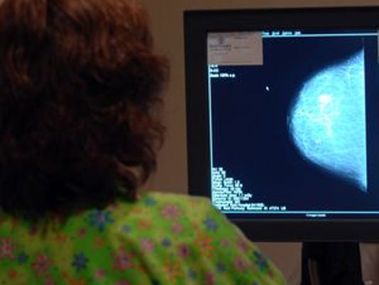 What women should know about breast cancer