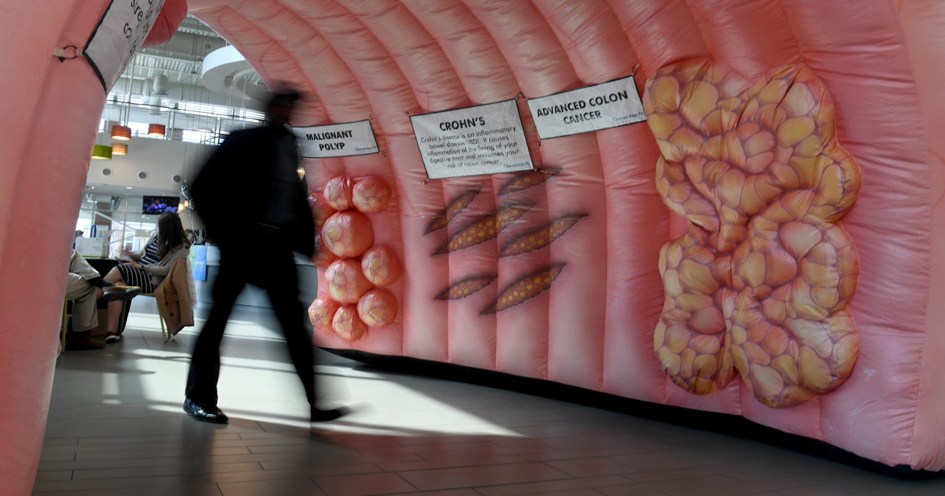 Giant inflatable colon stolen - and it's no laughing matter