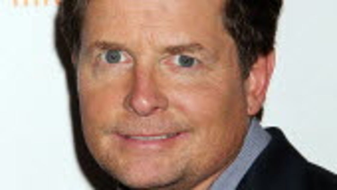 Alzheimer's, Parkinson's groups team up for research