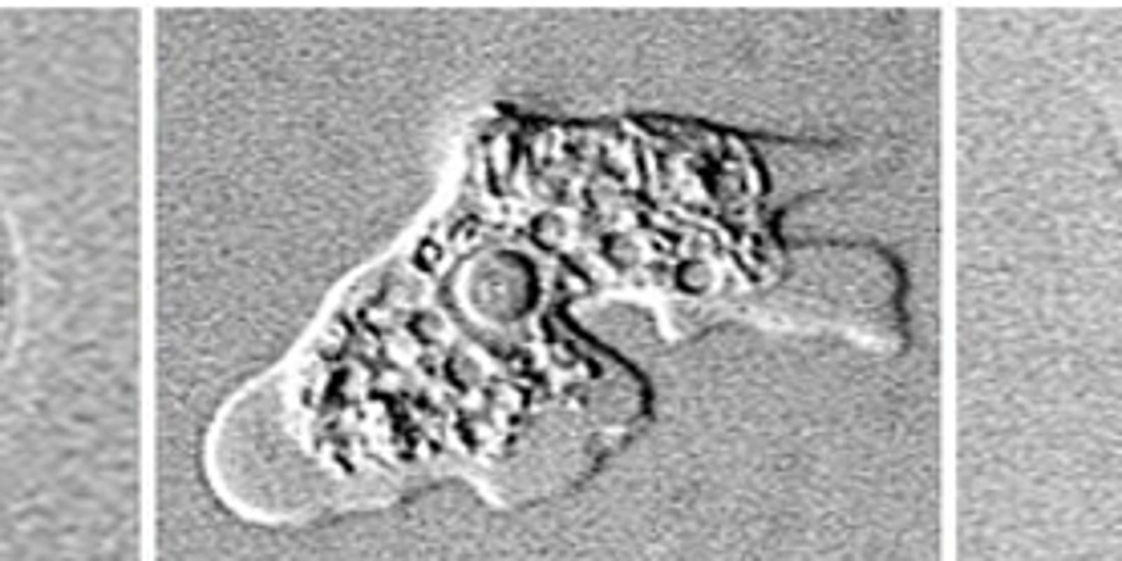 How 'rare' is illness from brain-eating amoeba? Very