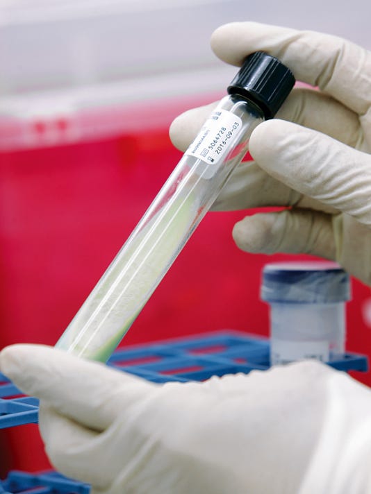 YISD students possibly exposed to tuberculosis