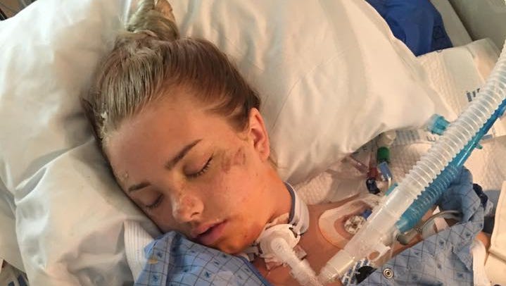 Teen critically injured in crash remains in coma