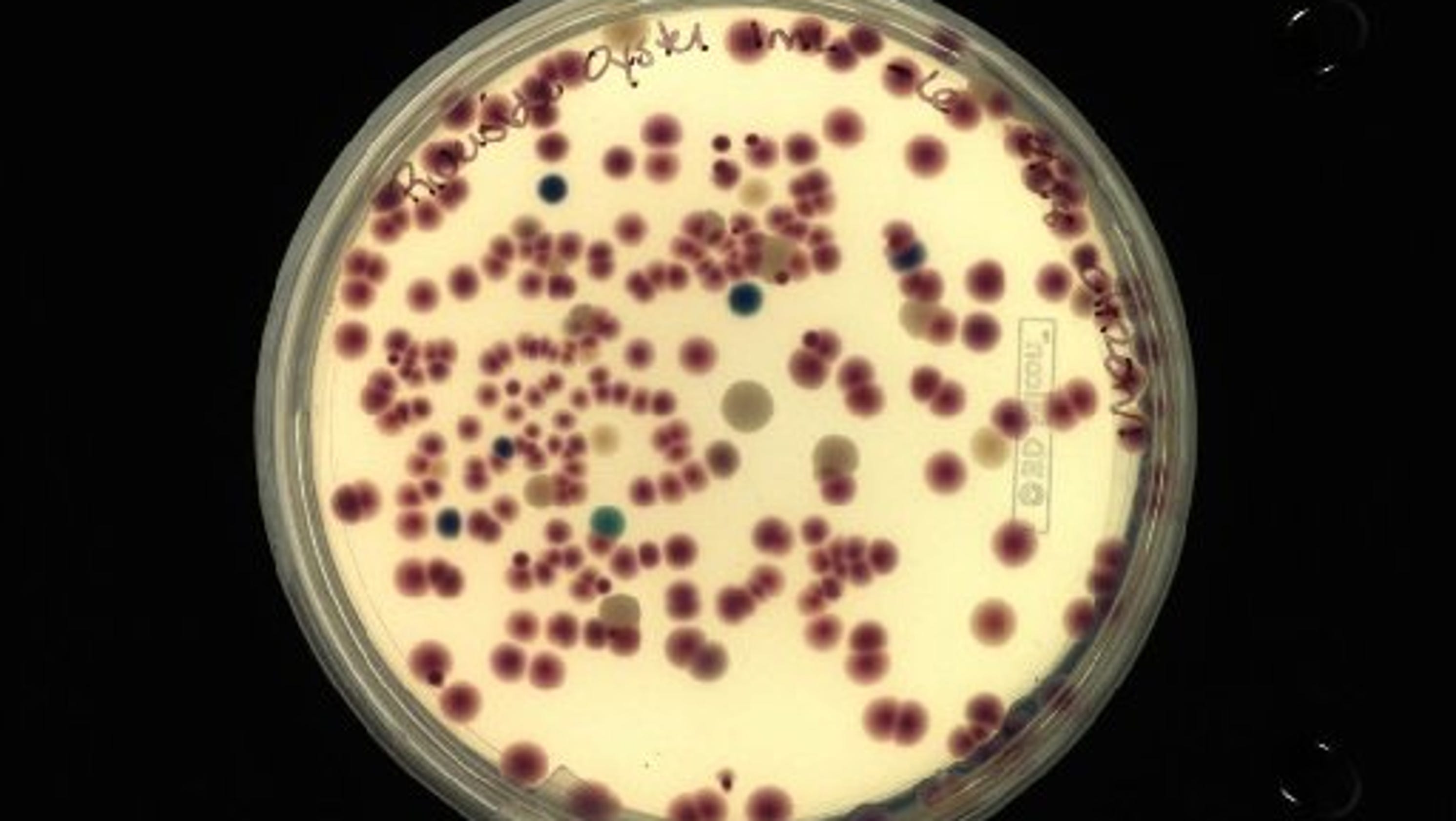 Vibrio vulnificus infections, deaths in Florida increased in 2017