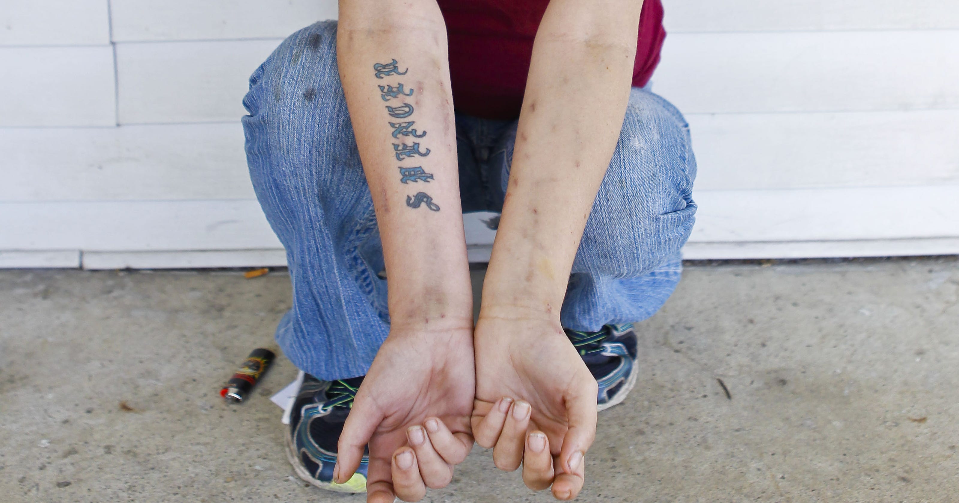 Indiana's HIV outbreak was avoidable, study says