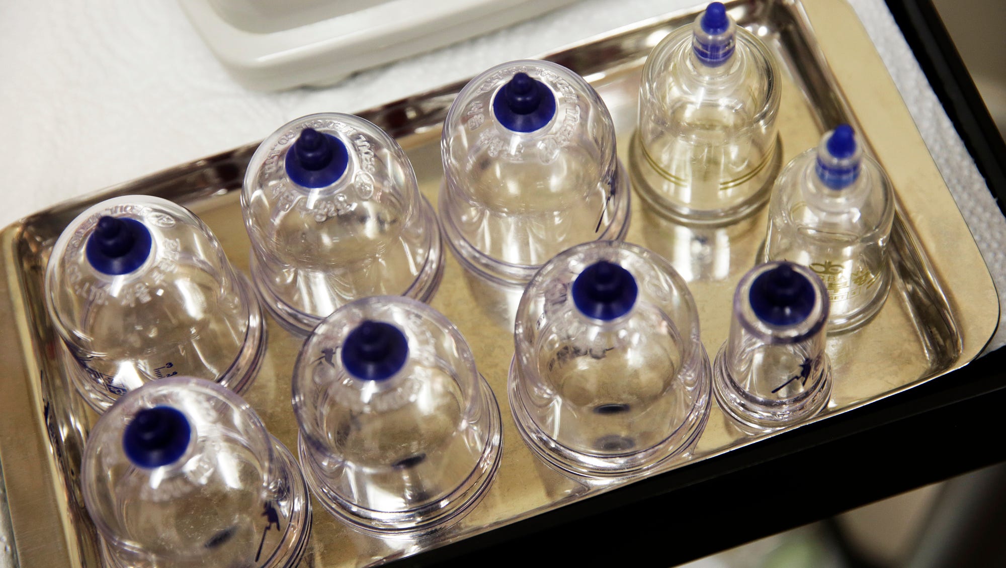 Fact check: Cupping therapy will not remove vaccine from the body