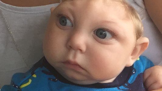 Baby Born Without Head