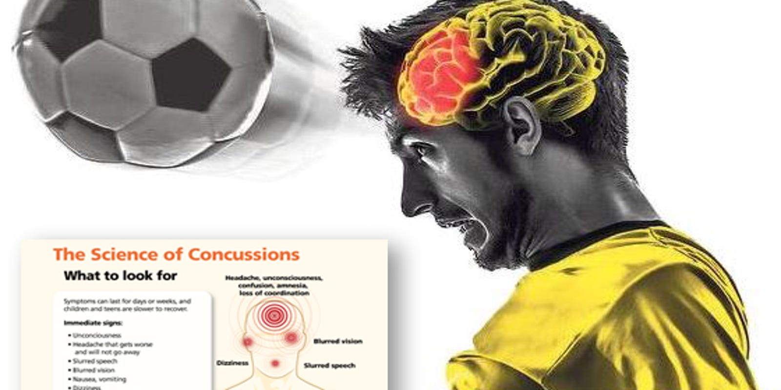 Lasting impact: concussions in soccer