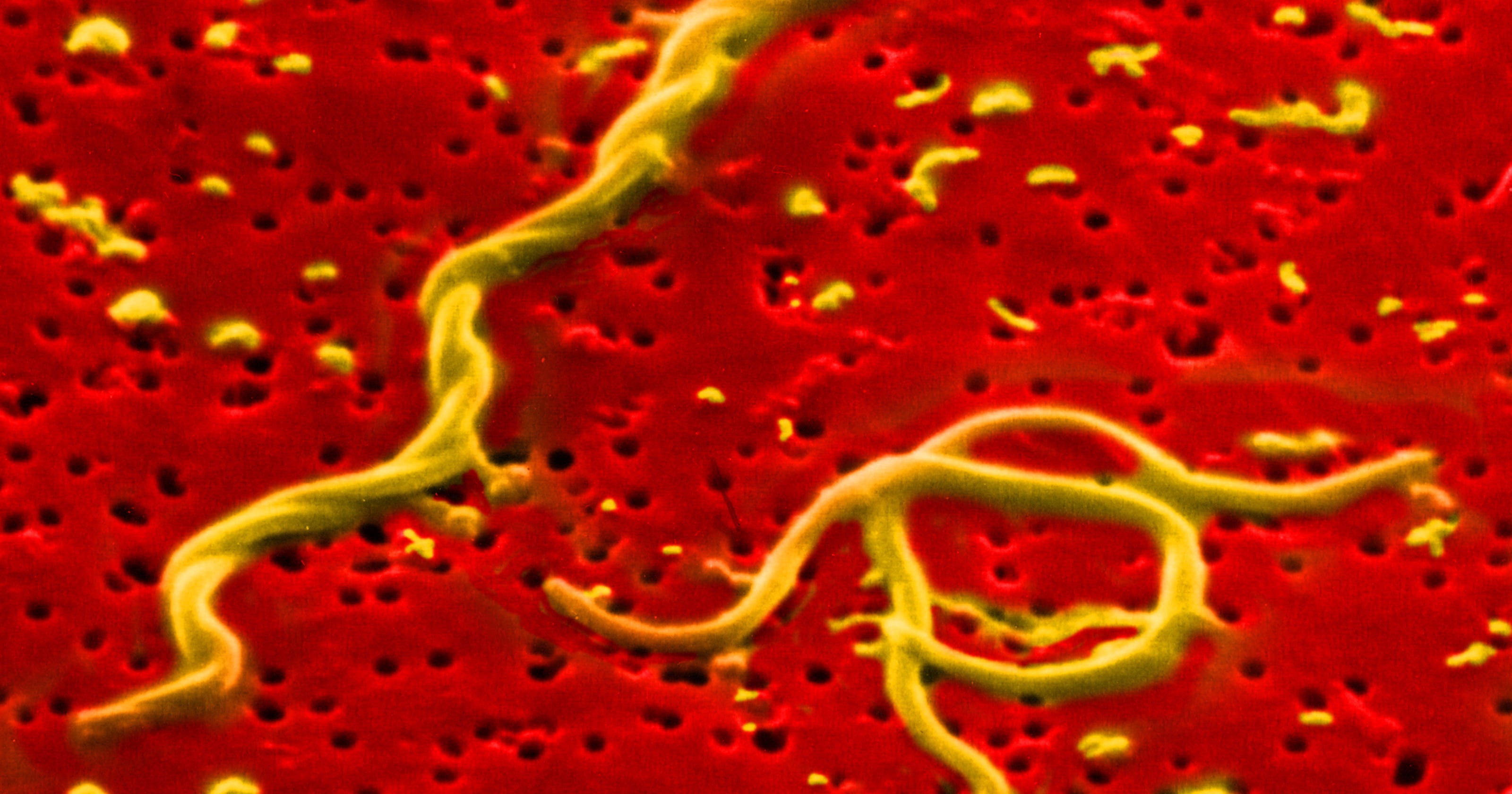 Bill protecting longer Lyme treatments heads to Cuomo