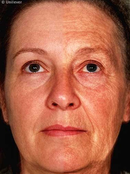 Look older? Might be your genes, study says Look older? Might be your genes, study says