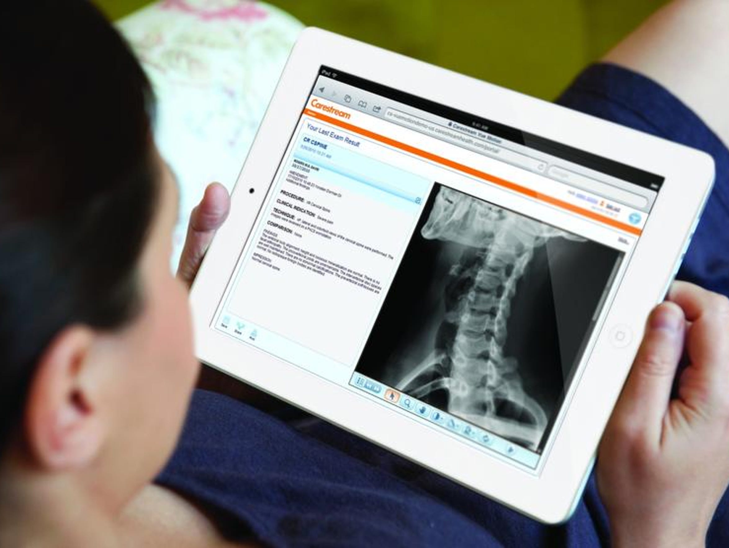 Carestream Health transforms into leader in digital medical imaging