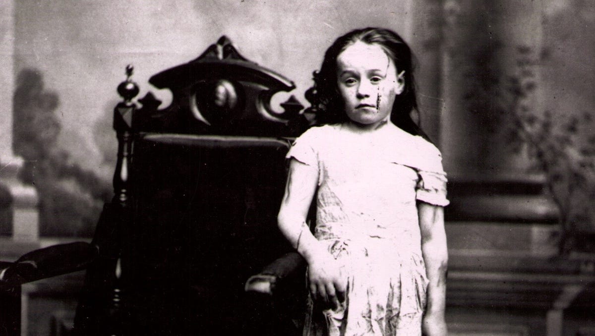 Mary Ellen Wilson: The case that changed child abuse