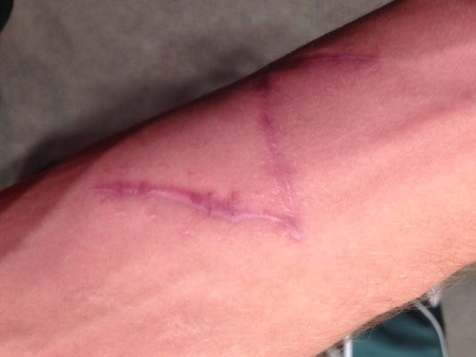 Red Wings' Darren Helm says severe cut has healed