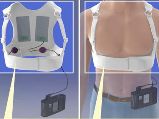 Defibrillator vest saves man from death 3 times