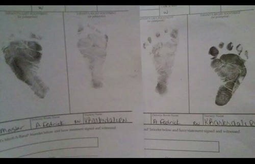 Jacksonville conjoined twins survive first surgery | cbs8.com