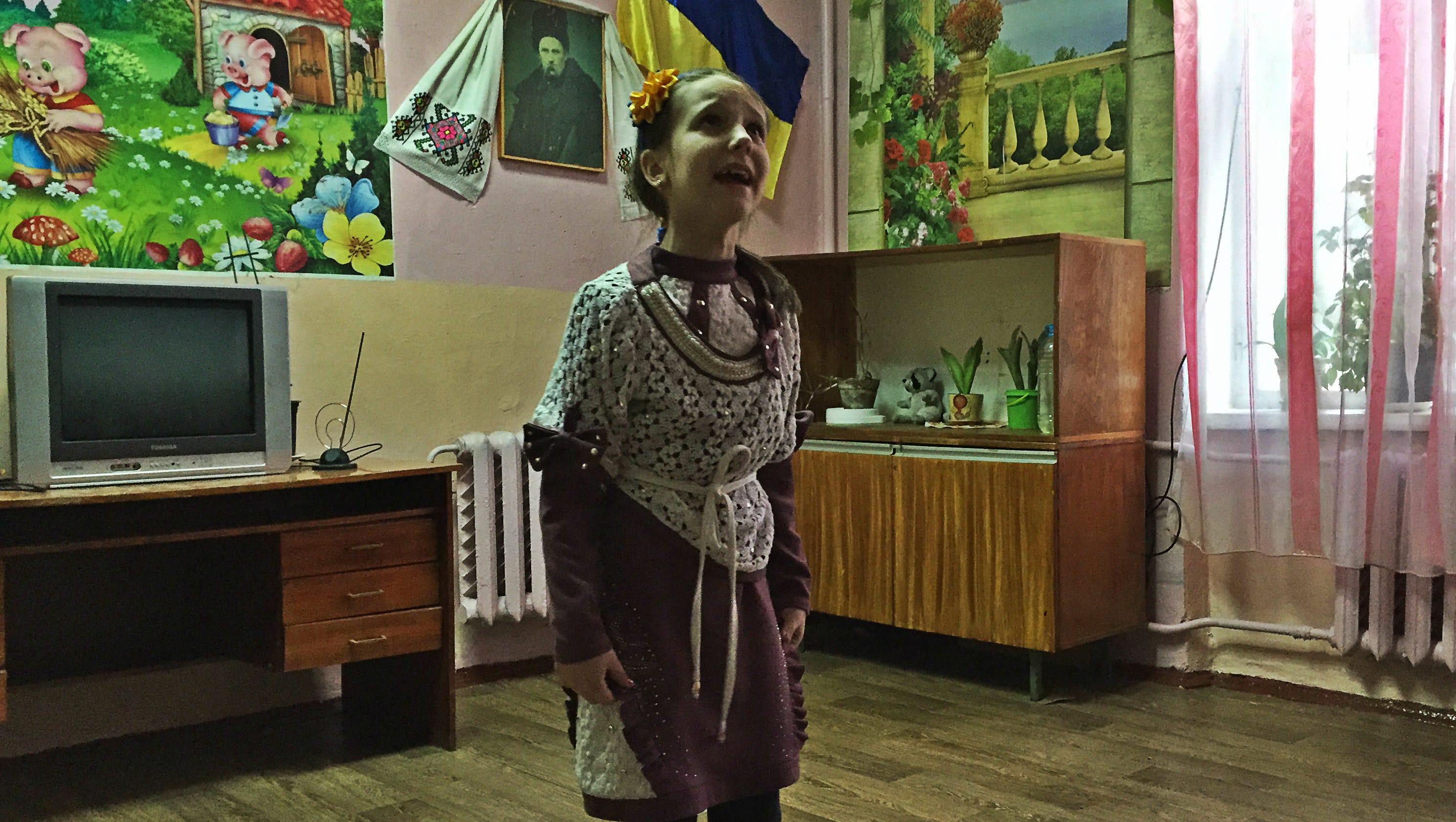 Chernobyl's legacy: Kids with bodies ravaged by disaster