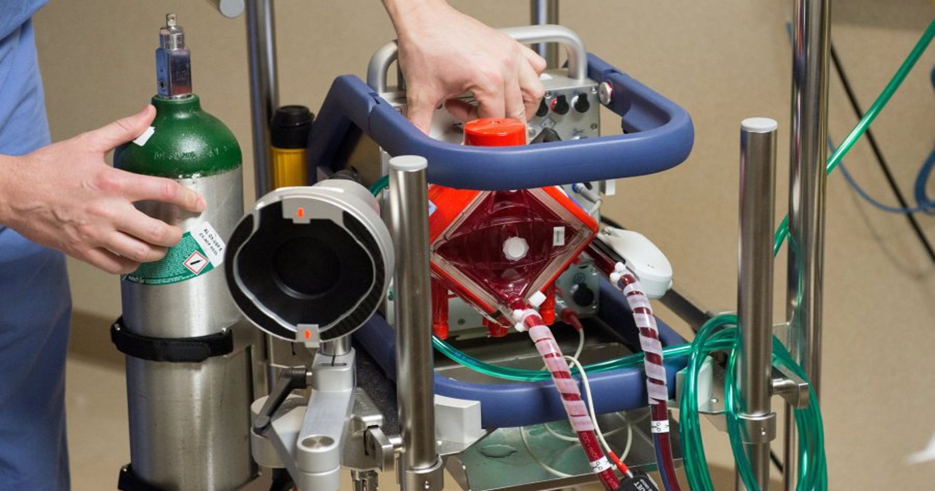 ECMO treatment helps save California woman's life