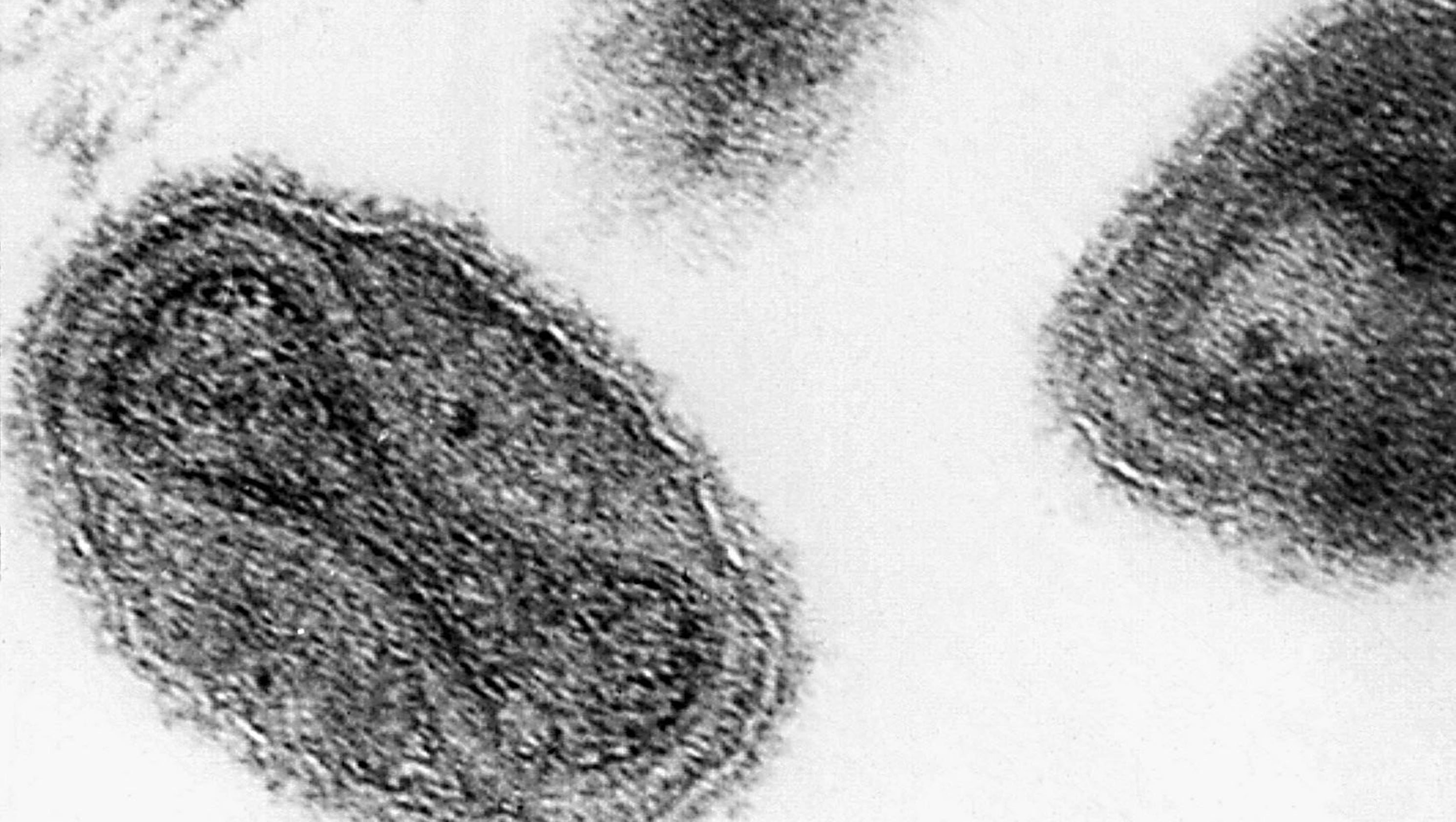 CDC increases regulations after anthrax, smallpox scares