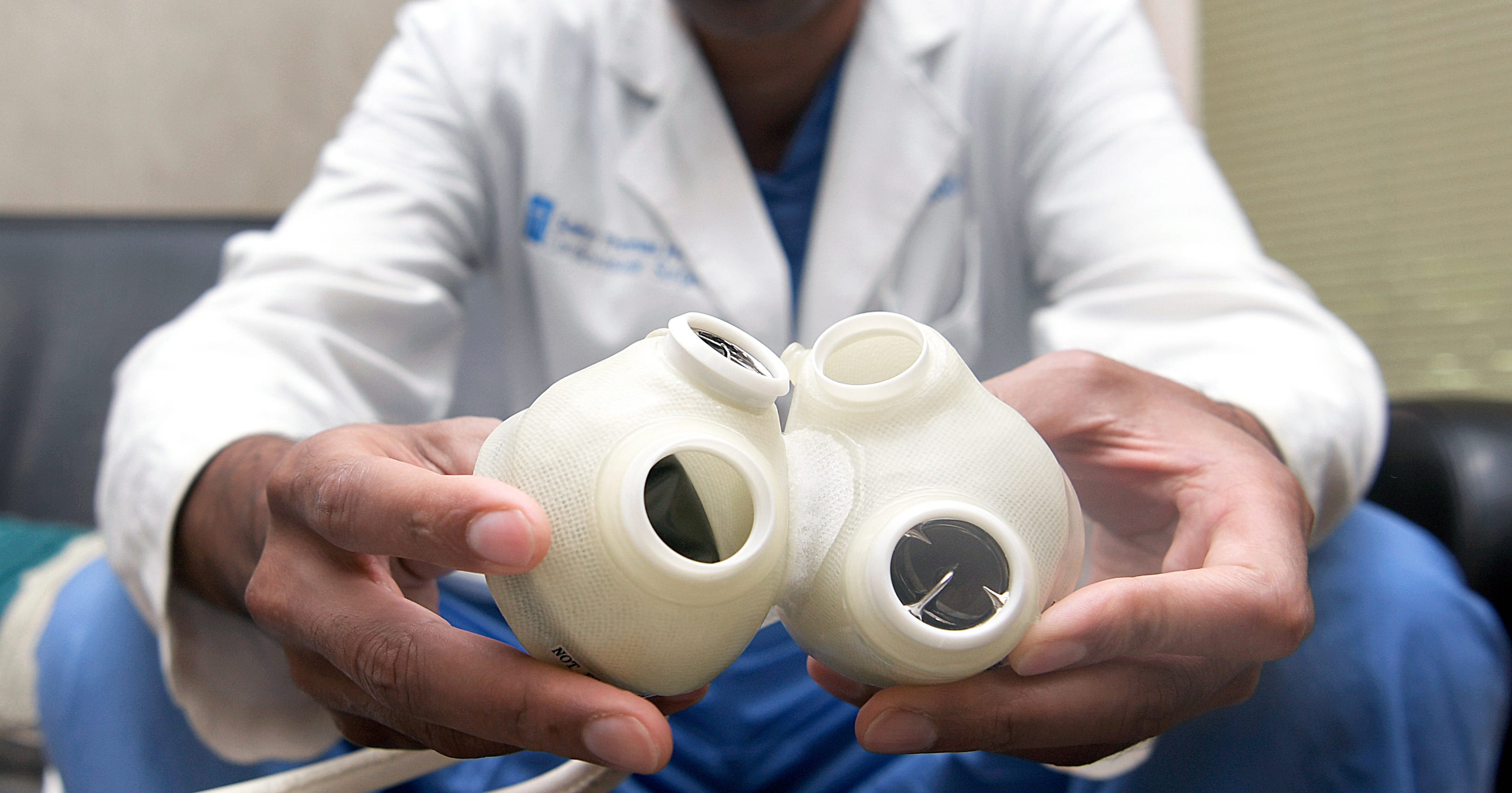 Saint Thomas surgeons can now implant totally artificial hearts