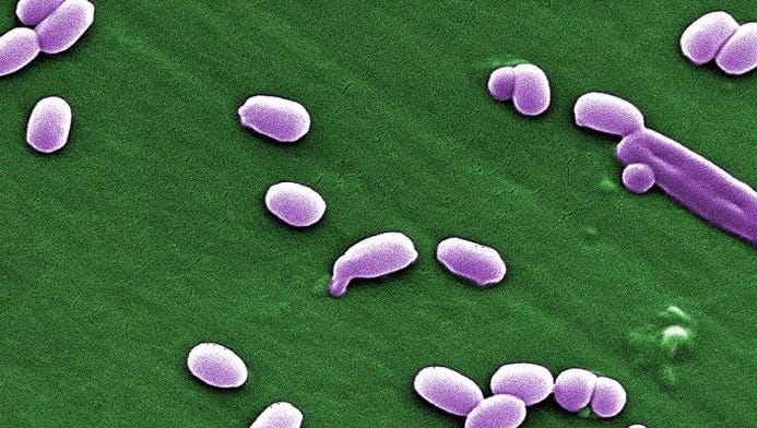 Pentagon: Poor testing led to Army shipping live anthrax