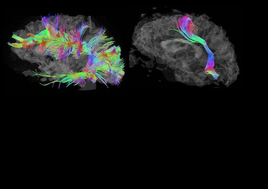 Temple Grandin on how the autistic 'think different'