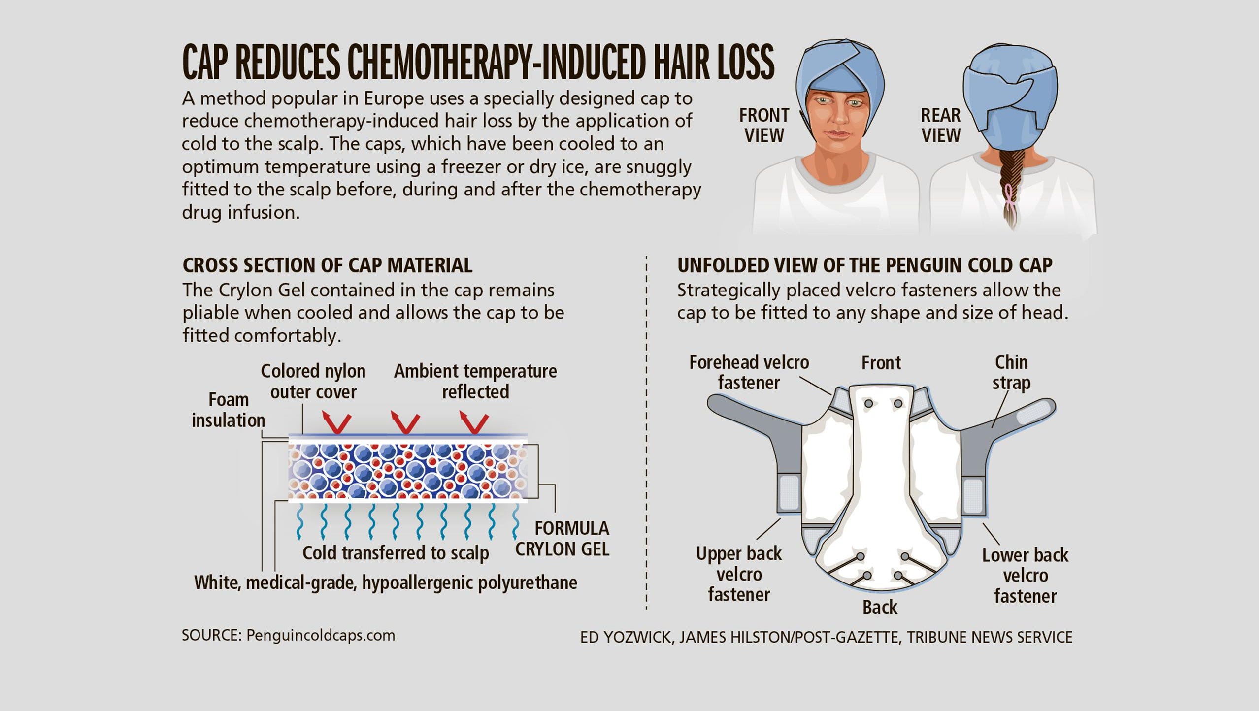 New treatment may cut hair loss from chemo