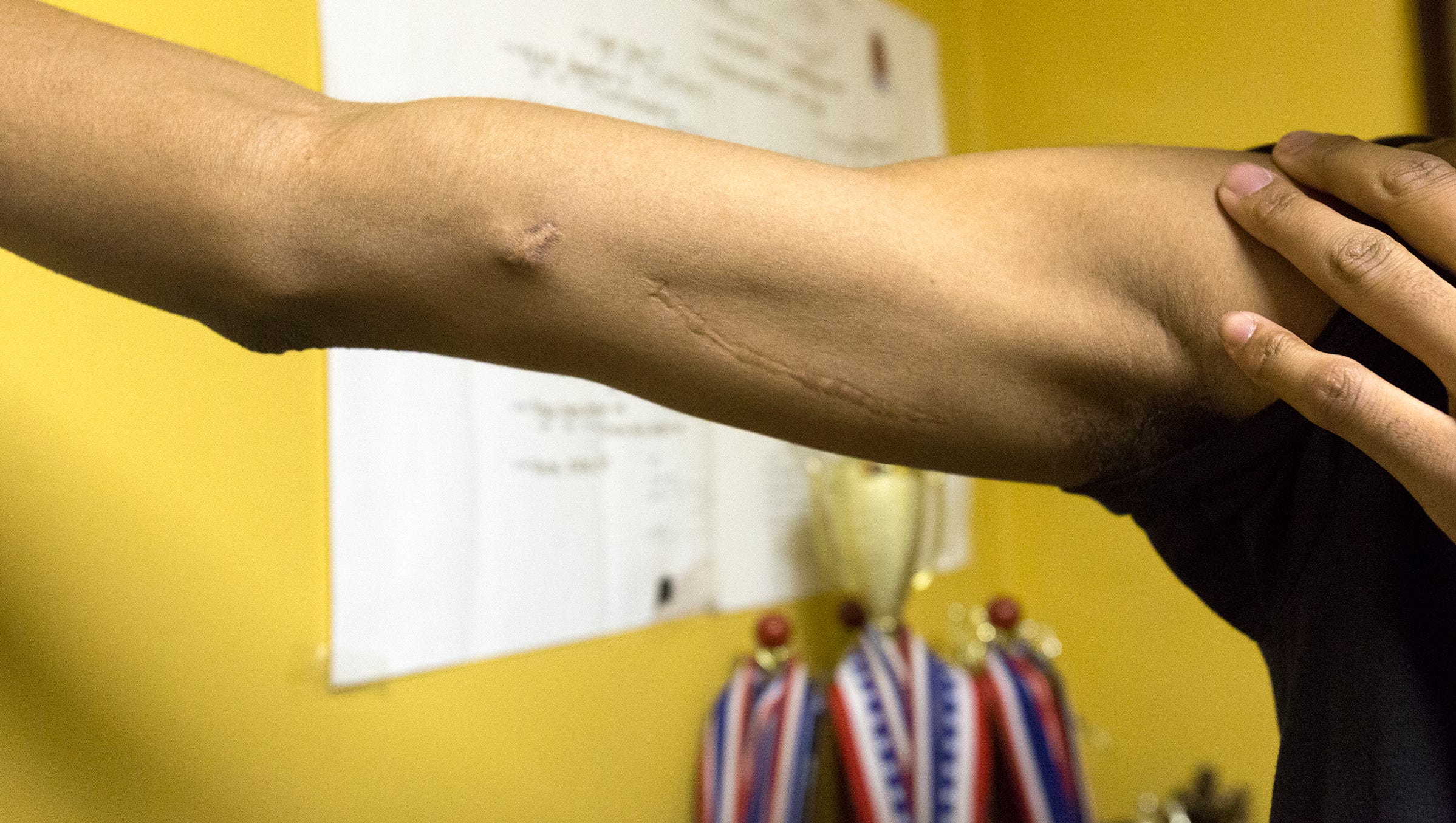 Meet the youngest survivors of Detroit's shootings and violence