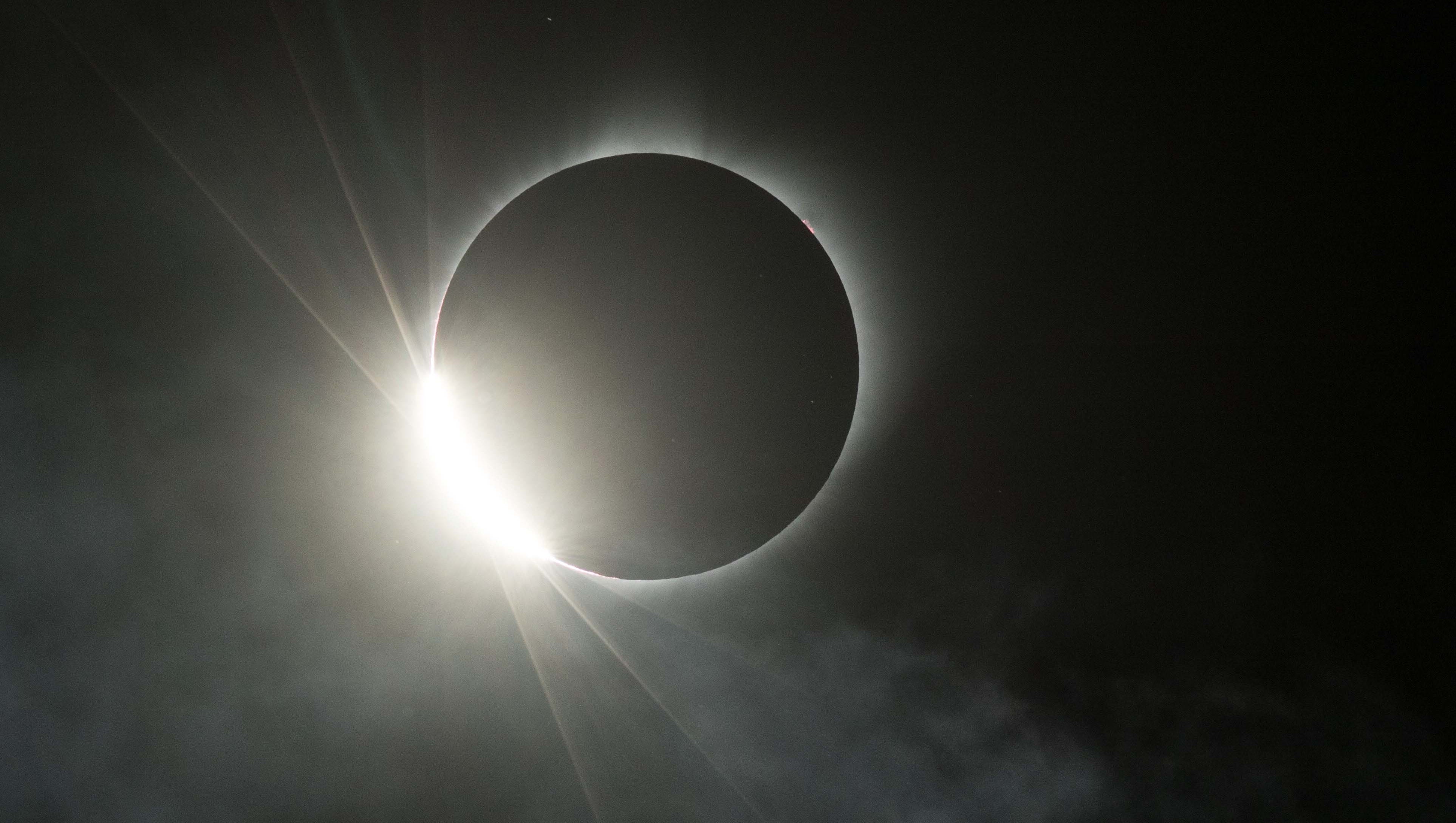 Solar Eclipse: Doctors are already seeing injuries from the eclipse