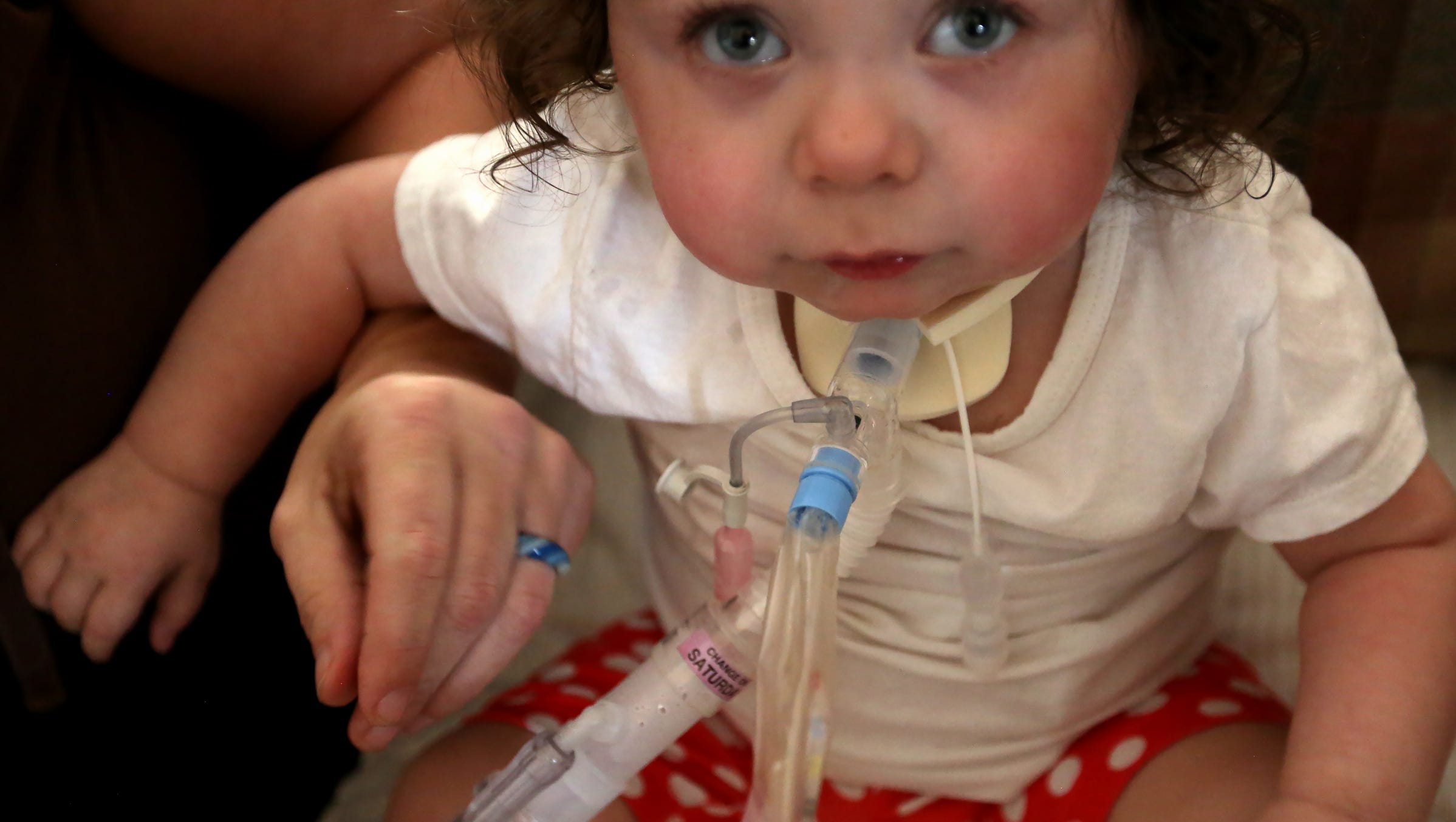 Child on ventilator, family avoid eviction