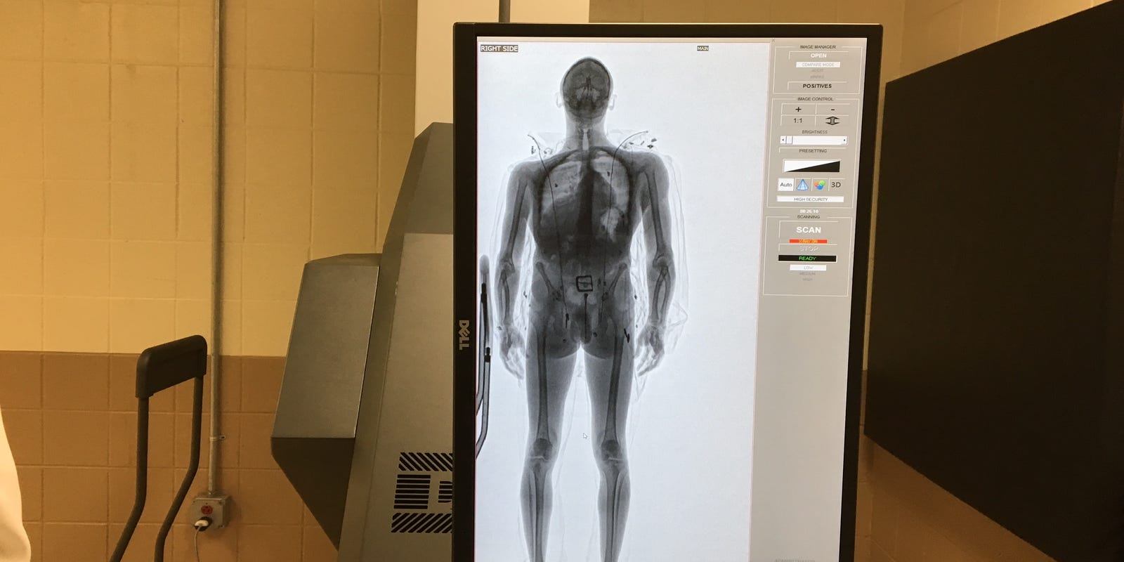 Full body scanner to detect weapons, drugs in use at Morris County jail