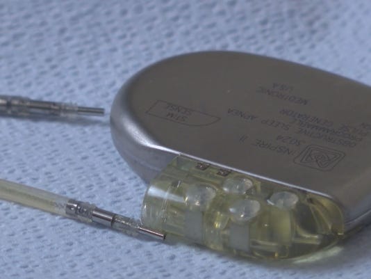 Pacemaker type implant can treat sleep apnea.