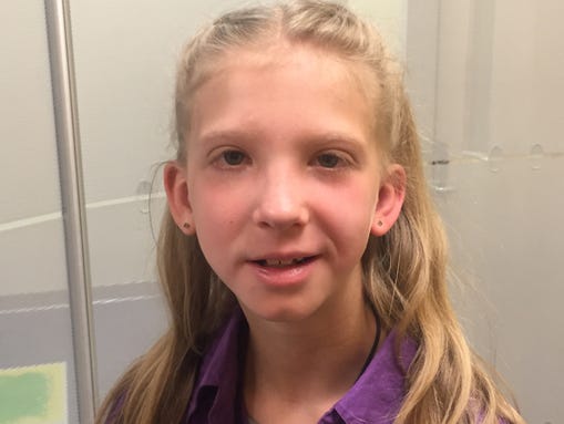 Girls with autism 'fly under the radar'