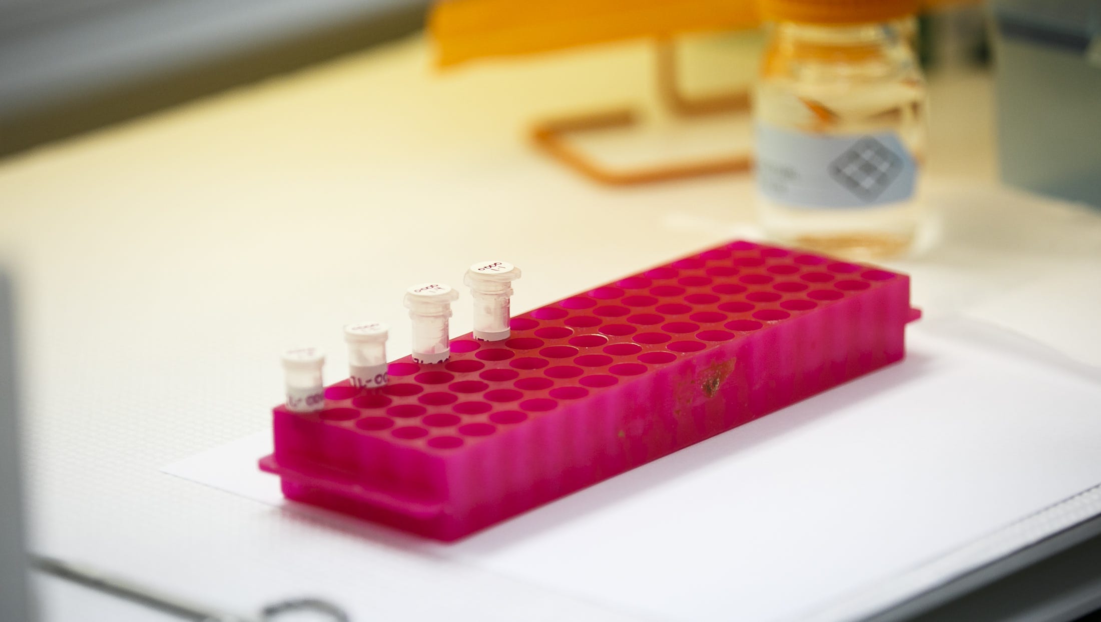 How are rape kits processed?