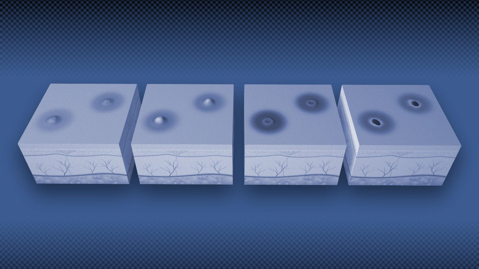 What does monkeypox rash look like? A visual guide to how it spreads